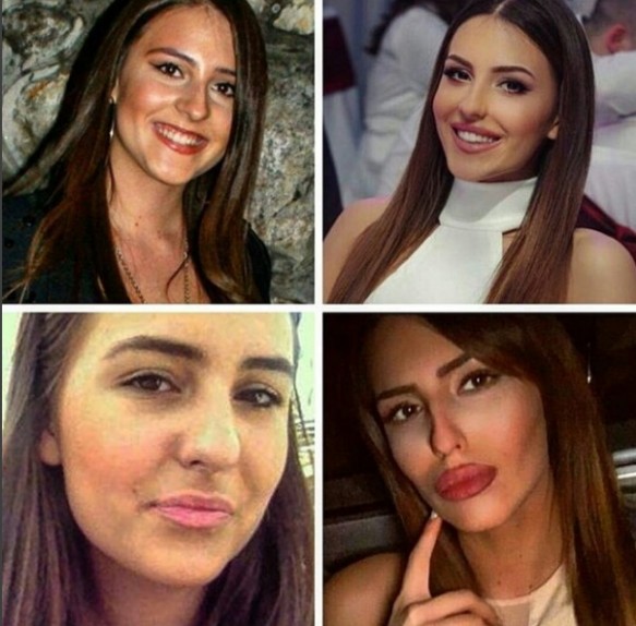 FOTO: Ovako je Anastasija Ražnatović izgledala prije ESTETSKIH OPERACIJA!